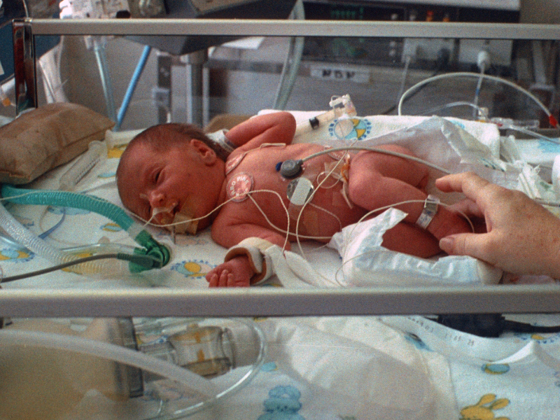 Neonatologia: Cuidado Especializado para os Recém-Nascidos